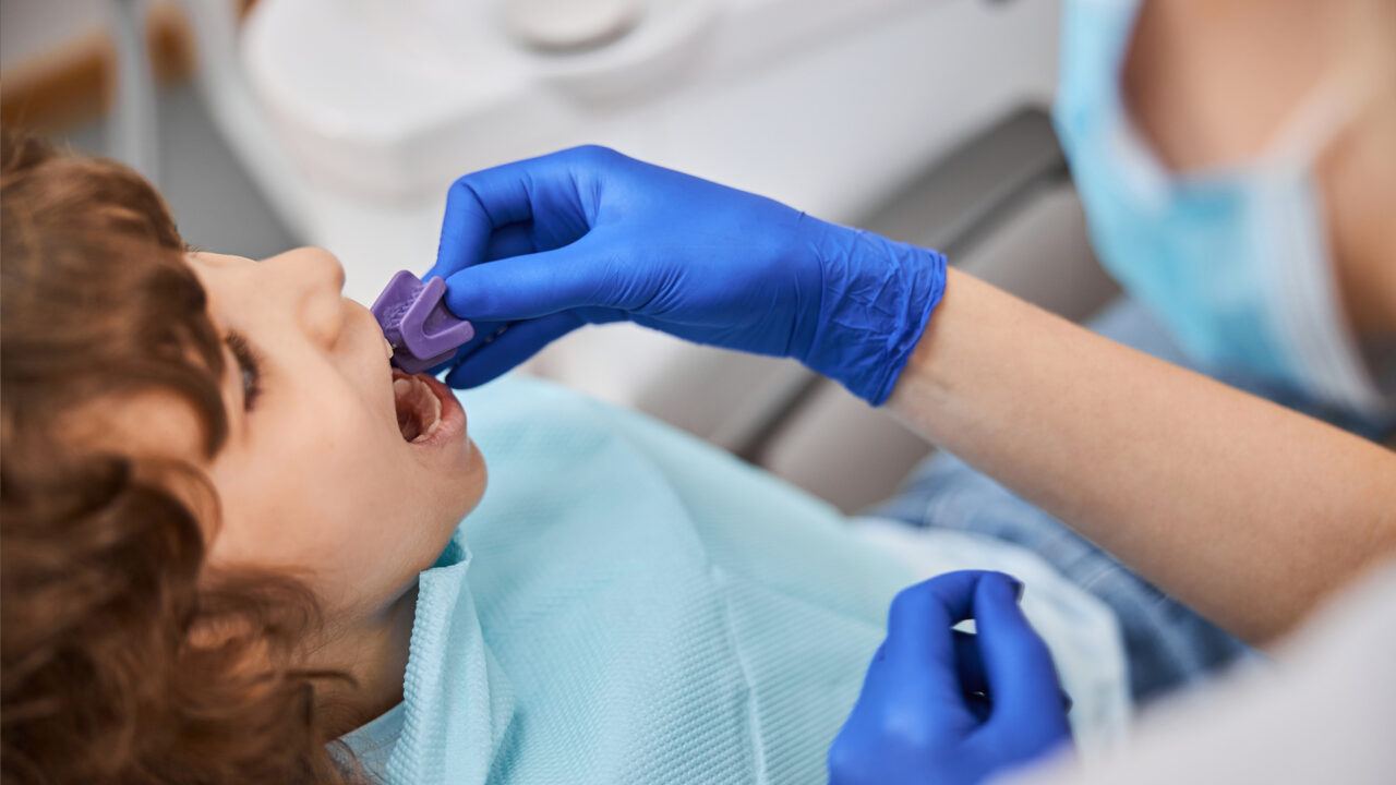 Kids Tooth Extraction in Singapore | TEETH @ Tiong Bahru