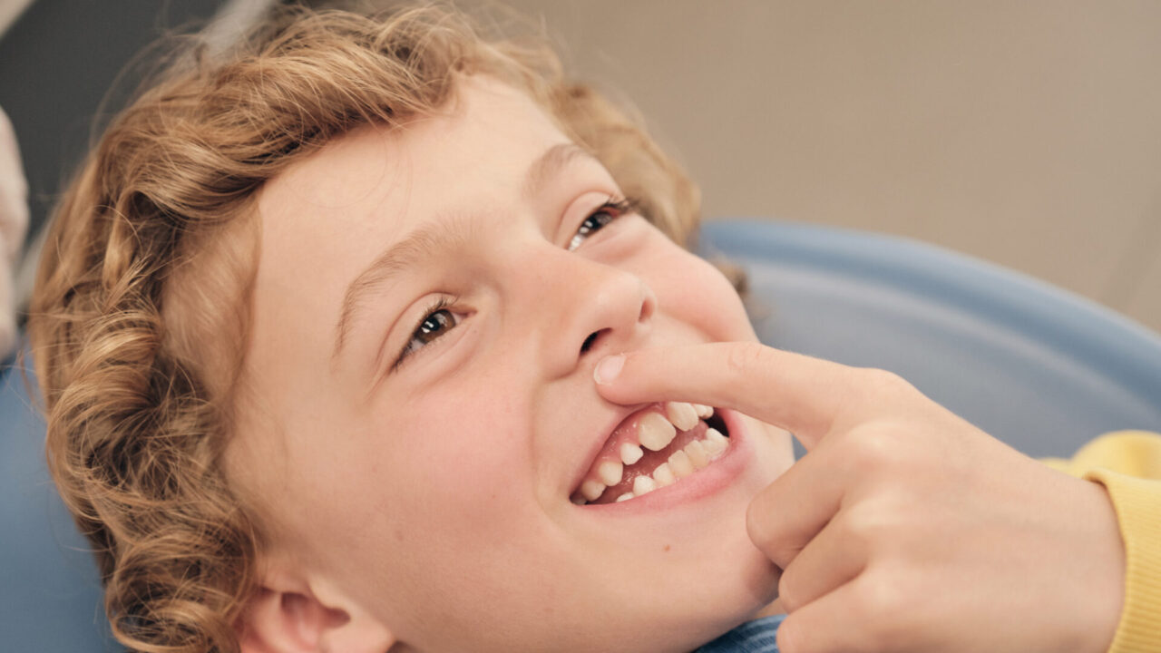 Prevent Tooth Decay in Children | TEETH @ Tiong Bahru